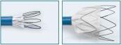 ePTFE Stents & Medical Device Covers | Duke Empirical